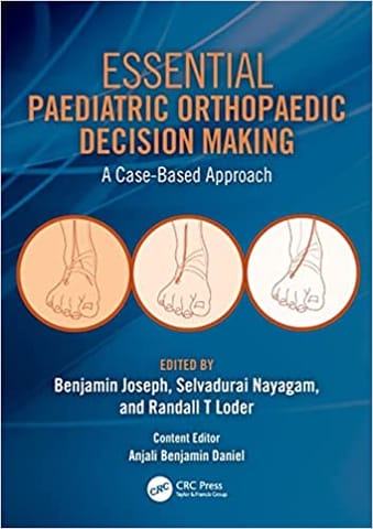Essential Paediatric Orthopaedic Decision Making A Case Based Approach ...