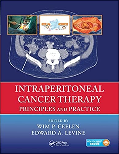 Intraperitoneal Cancer Therapy Principles and Practice 1st Edition 2020 ...