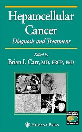 Hepatocellular Carcinoma Diagnosis And Treatment Second Edition 2005 By ...