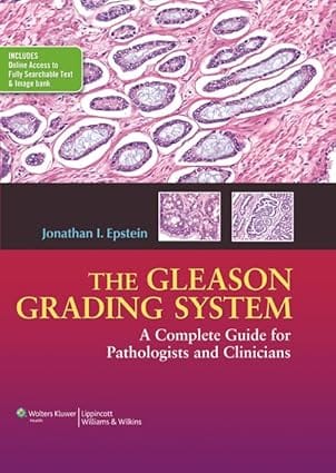 The Gleason Grading System A Complete Guide For Pathologists And And ...