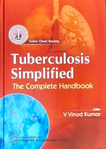 Tuberculosis Simplified The Complete Handbook 1st Edition 2024 By V ...
