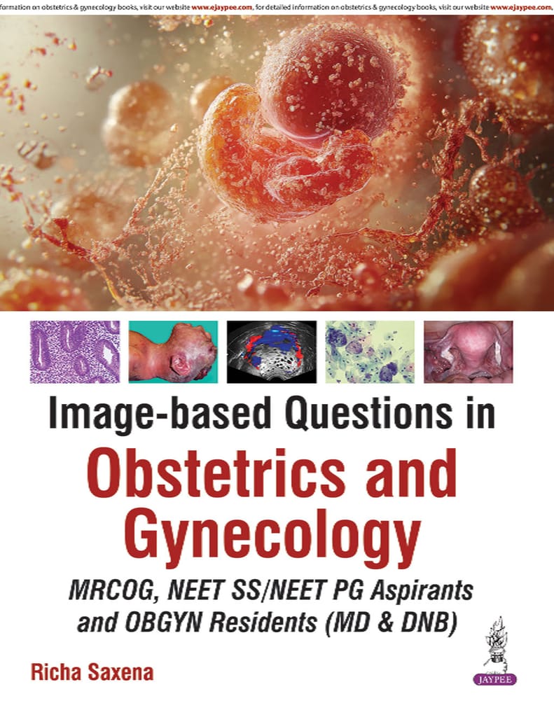Image-Based Questions In Obstetrics And Gynecology 1st Edition 2026 By ...