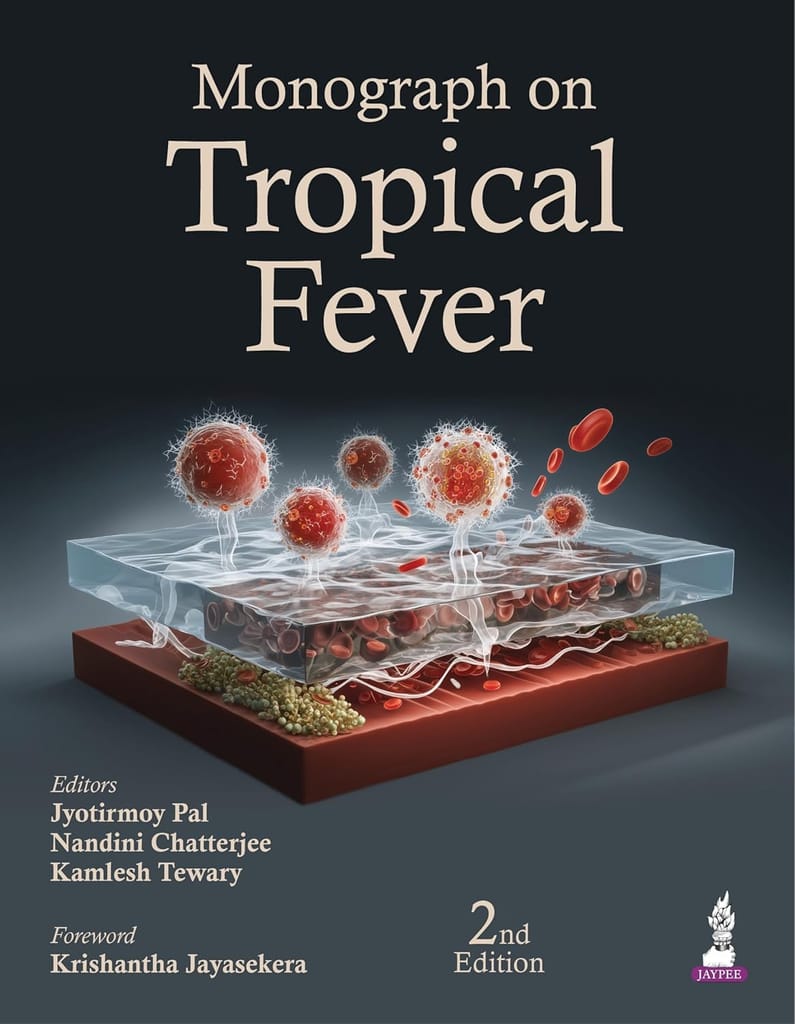 Monograph On Tropical Fever 2nd Edition 2026 By Jyotirmoy Pal