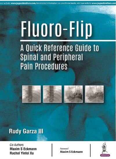 Fluoro-Flip A Quick Reference Guide To Spinal And Peripheral Pain ...